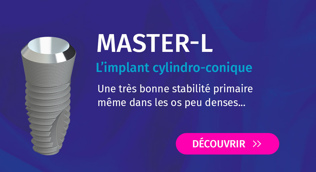 Implants Master – Easy Implant